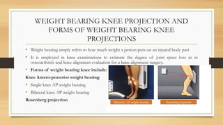 PREFERENCE OF WEIGHT BEARING OVER NON WEIGHT BEARING RADIOGRAPHIC ...