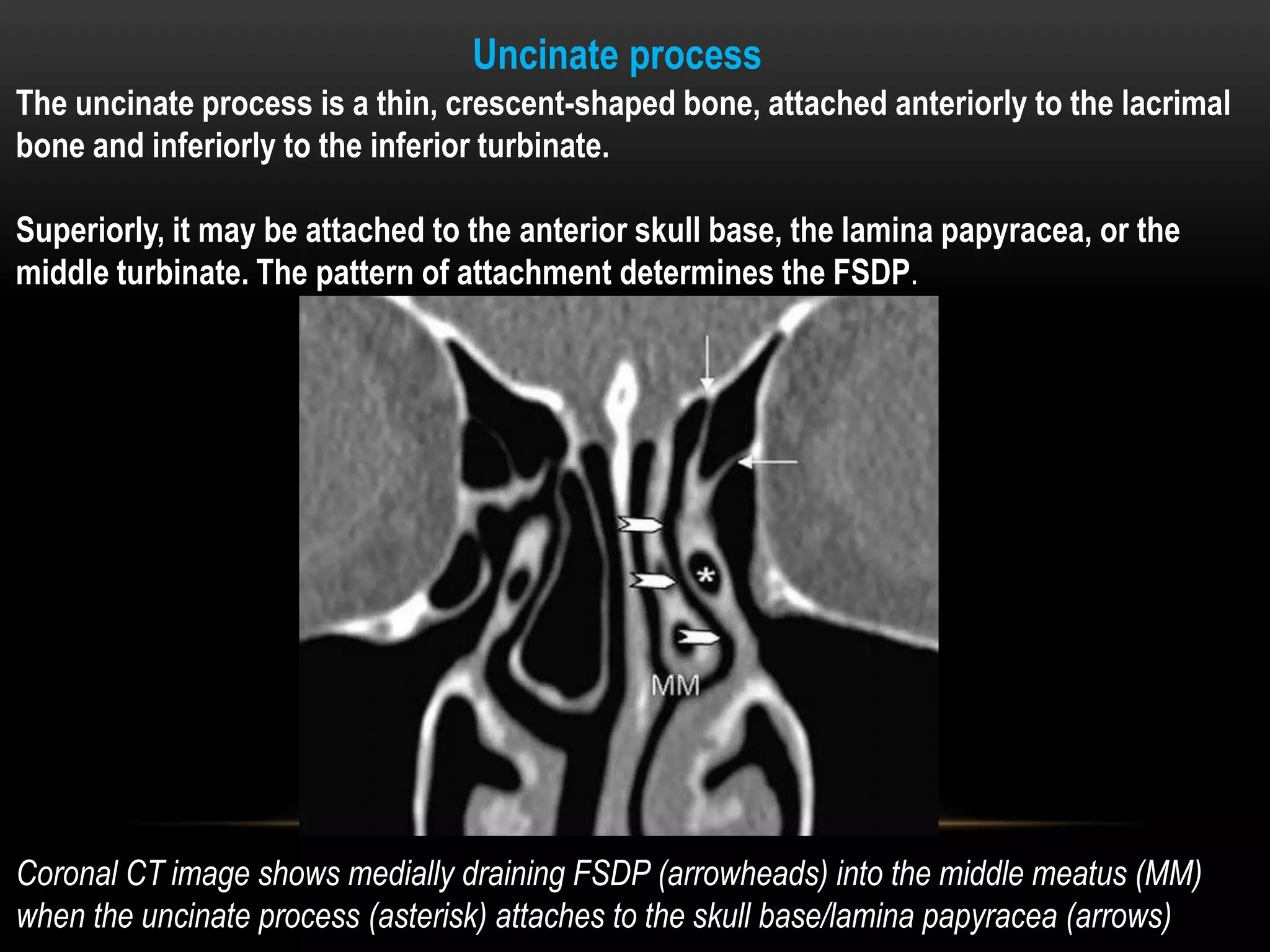 Pre fess pns ct | PPTX