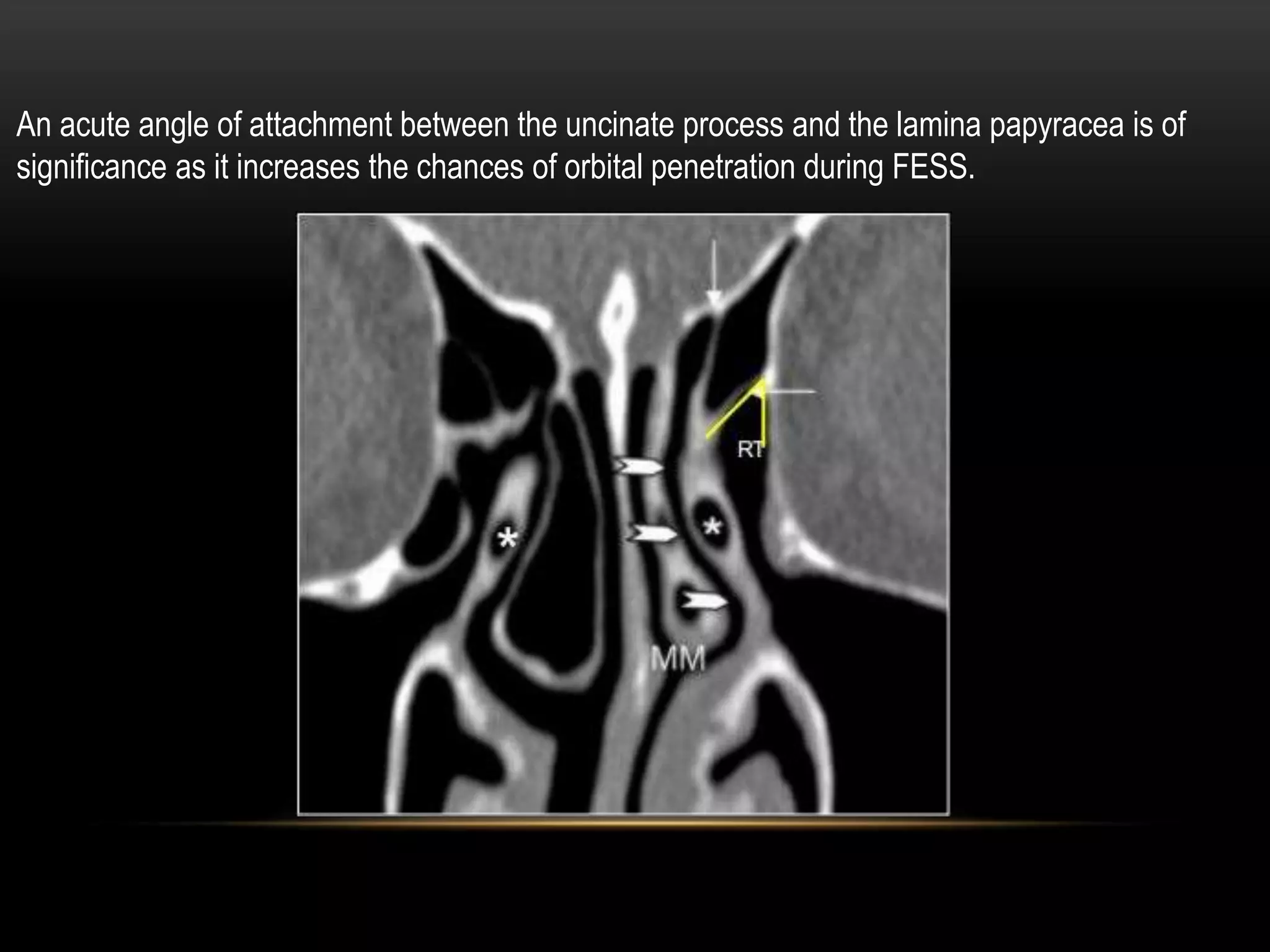 Pre fess pns ct | PPTX