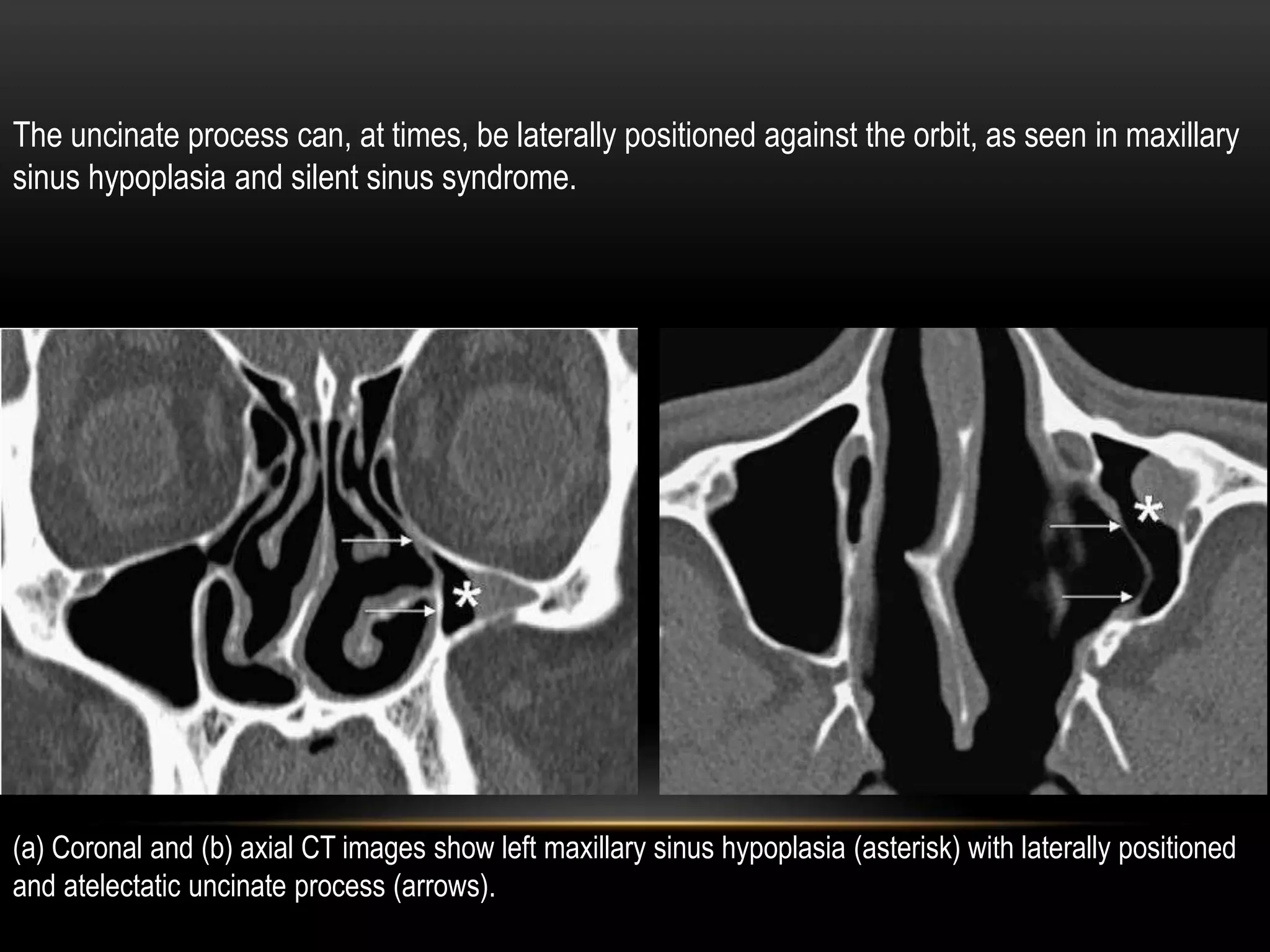 Pre fess pns ct | PPTX