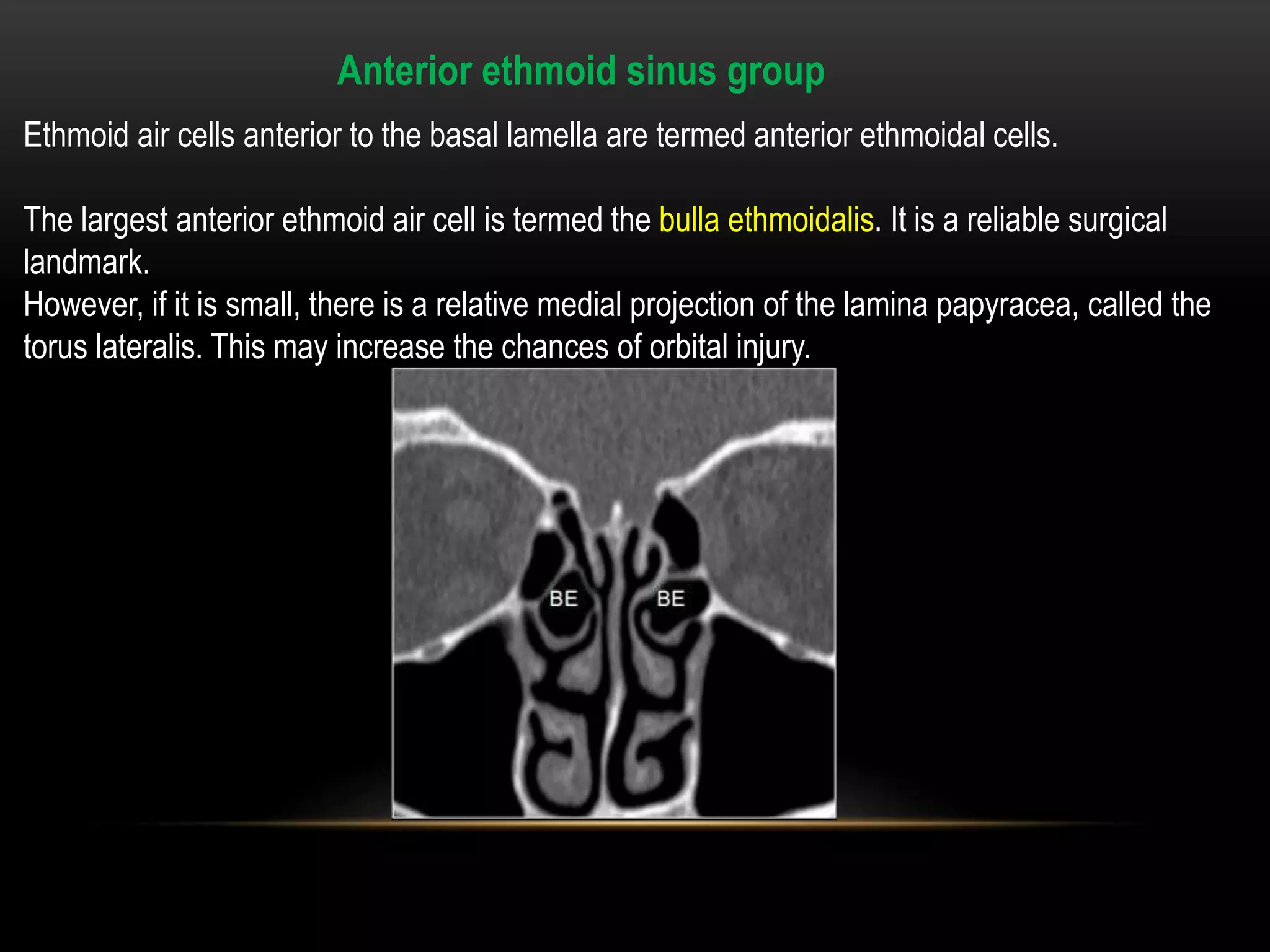 Pre-FESS PNS CT | PPT