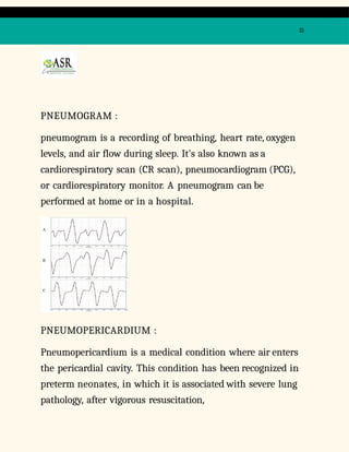 Prefixes _ PHLEBO AND PNEUMOby ASR .pptx