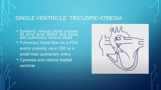 Pre Fontan Palliation Surgery in Single Ventricle Congenital Heart Disease.pptx