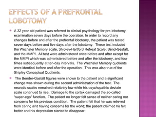 Prefrontal Lobotomy | PPT