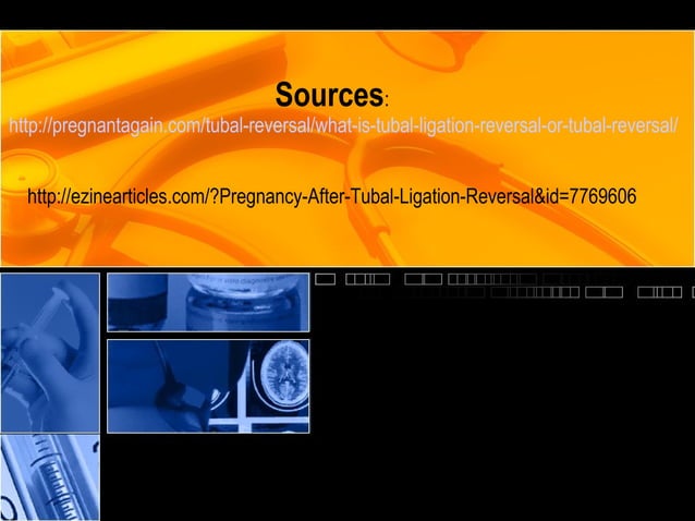 Pregnancy after tubal ligation reversal | PPT