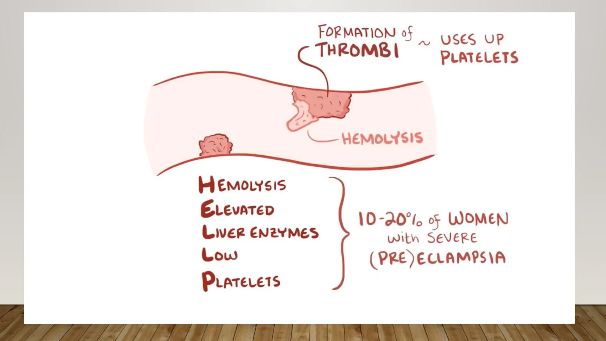 PREGNANCY INDUCED HYPERTENSION presentation.pptx