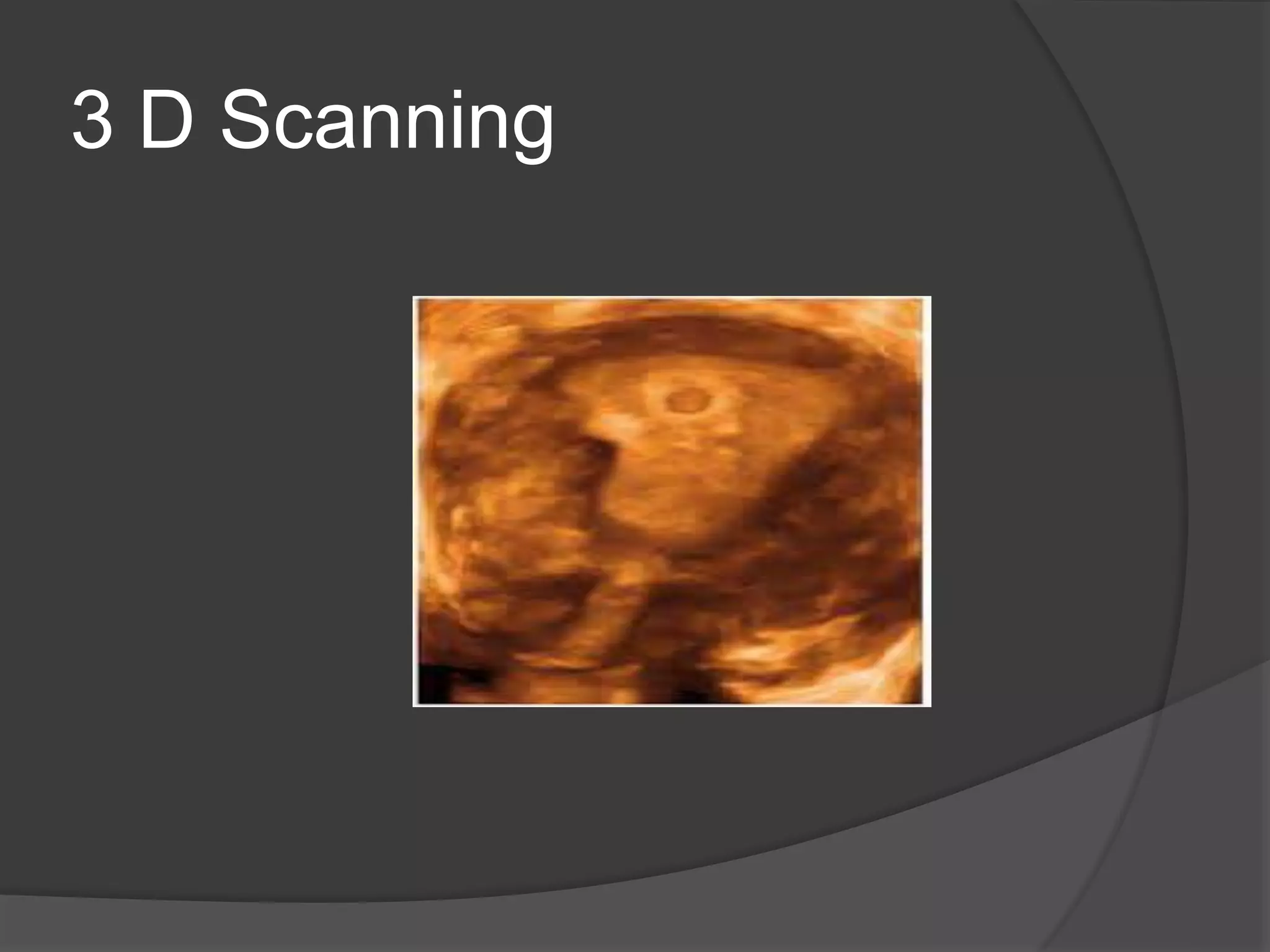 Pregnancy of unkown location | PPTX