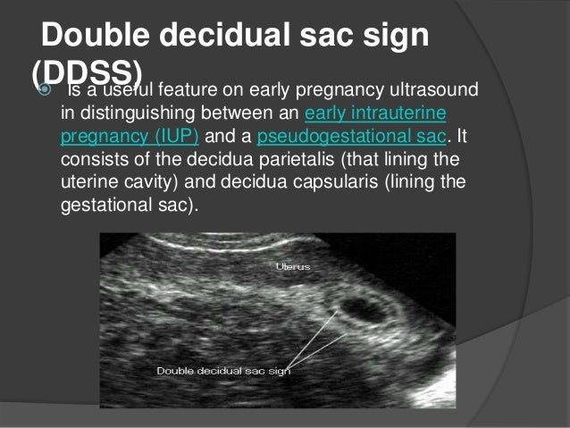 Pregnancy of unkown location