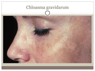 Physiology of Pregnancy for Undergraduates | PPT