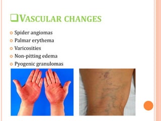 Pregnancy Related Dermatoses | PPTX