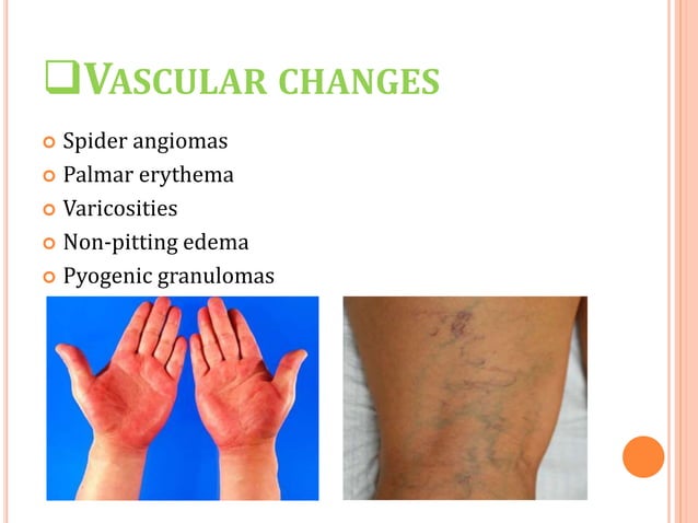 Pregnancy Related Dermatoses | PPTX
