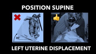 Cardiac Arrest Resuscitation in Pregnancy | PPT