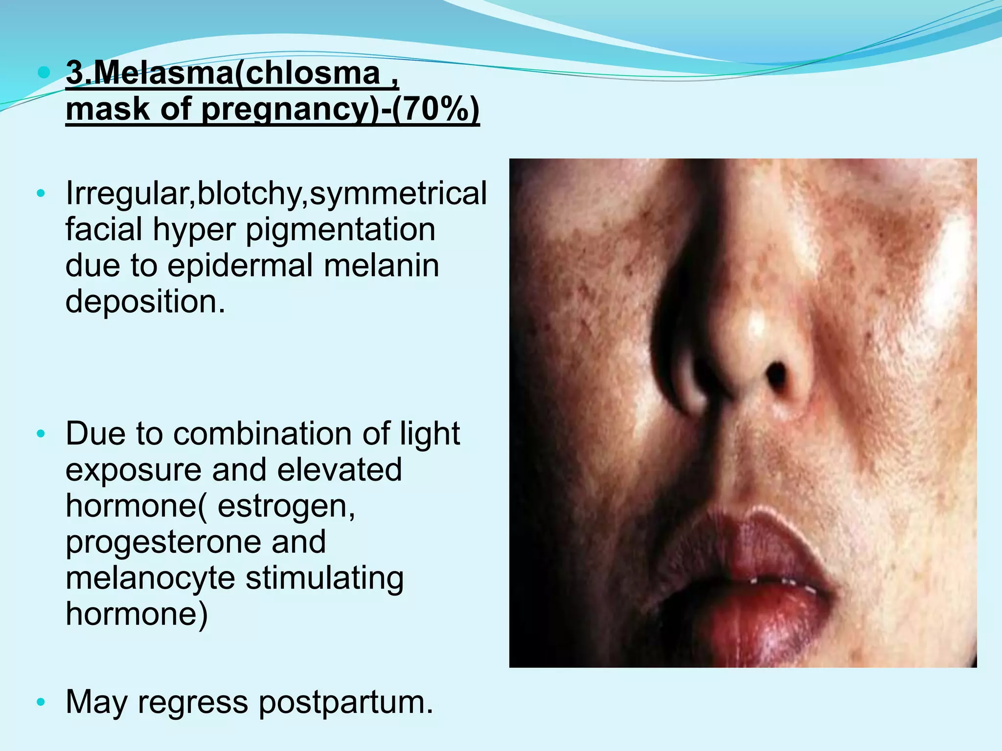 Pregnancy skin changes | PPTX