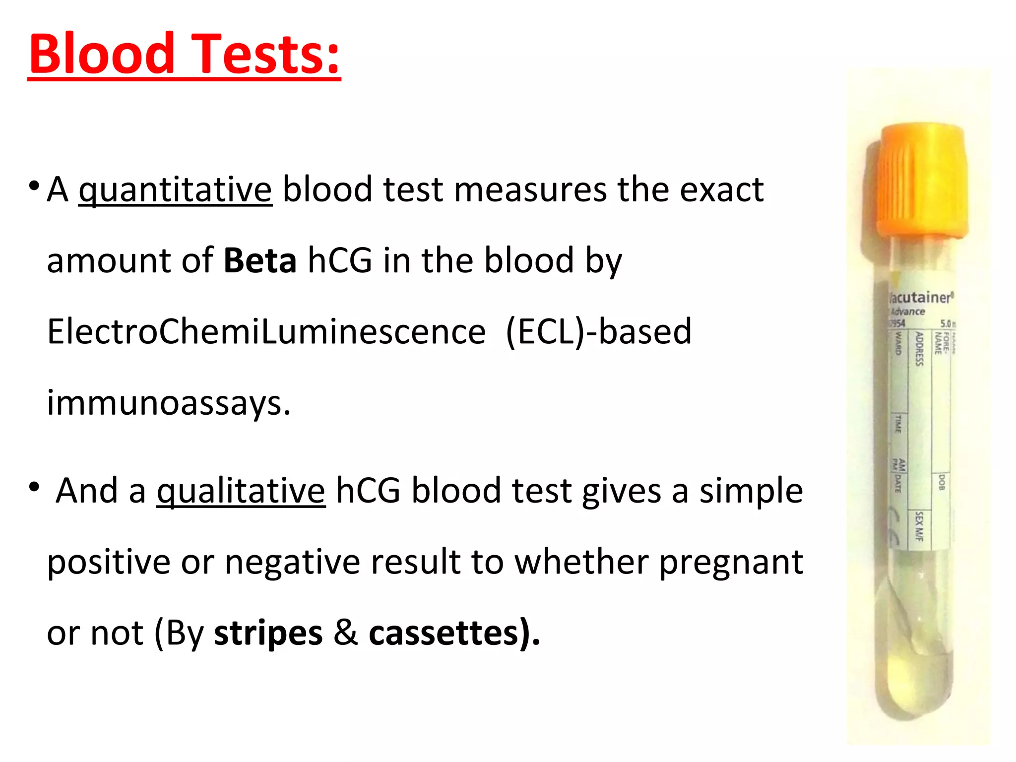 Pregnancy test | PPT