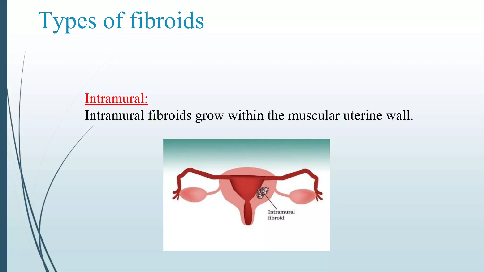 Pregnancy with fibroids | PPTX