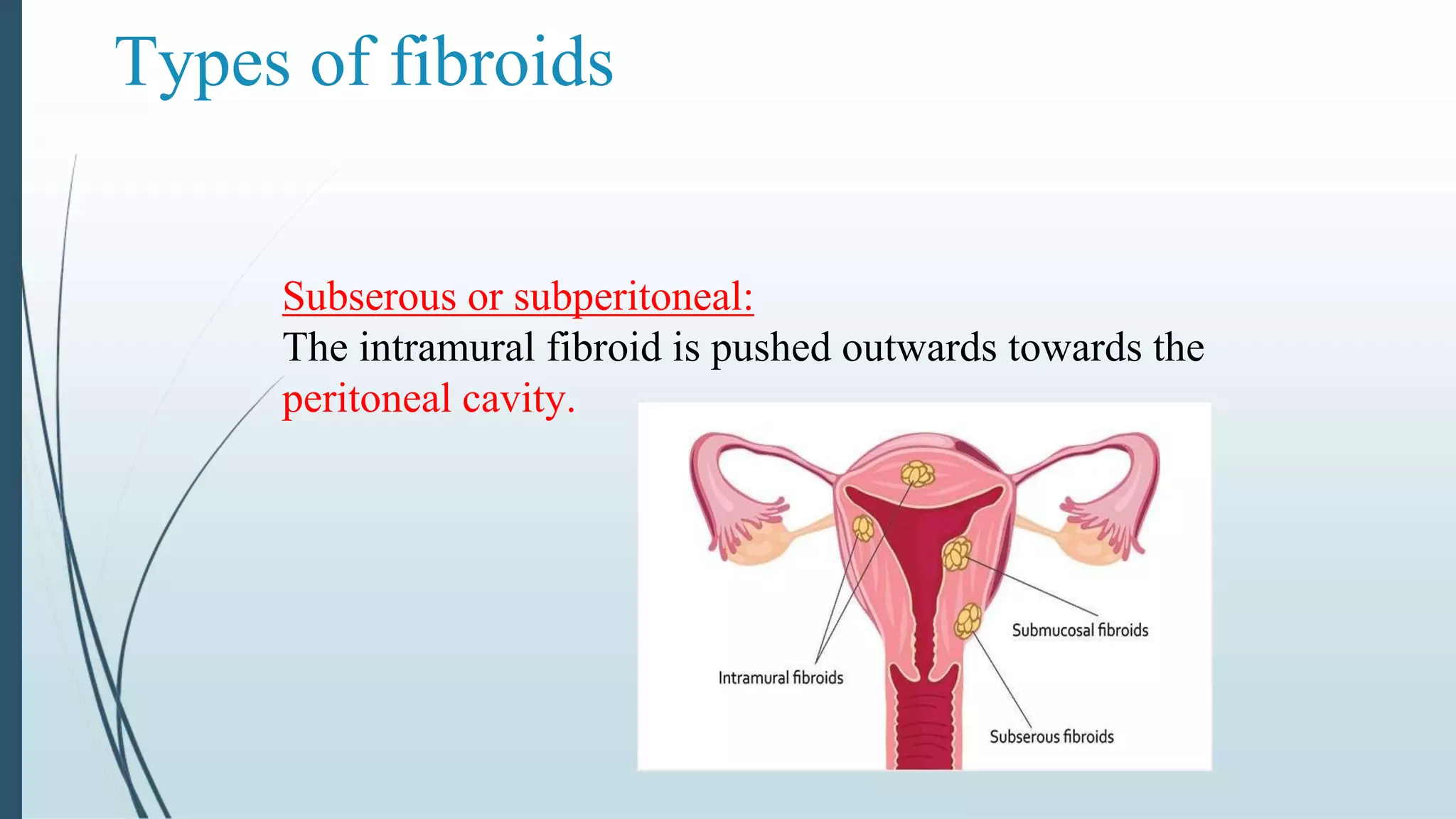 Pregnancy with fibroids | PPTX