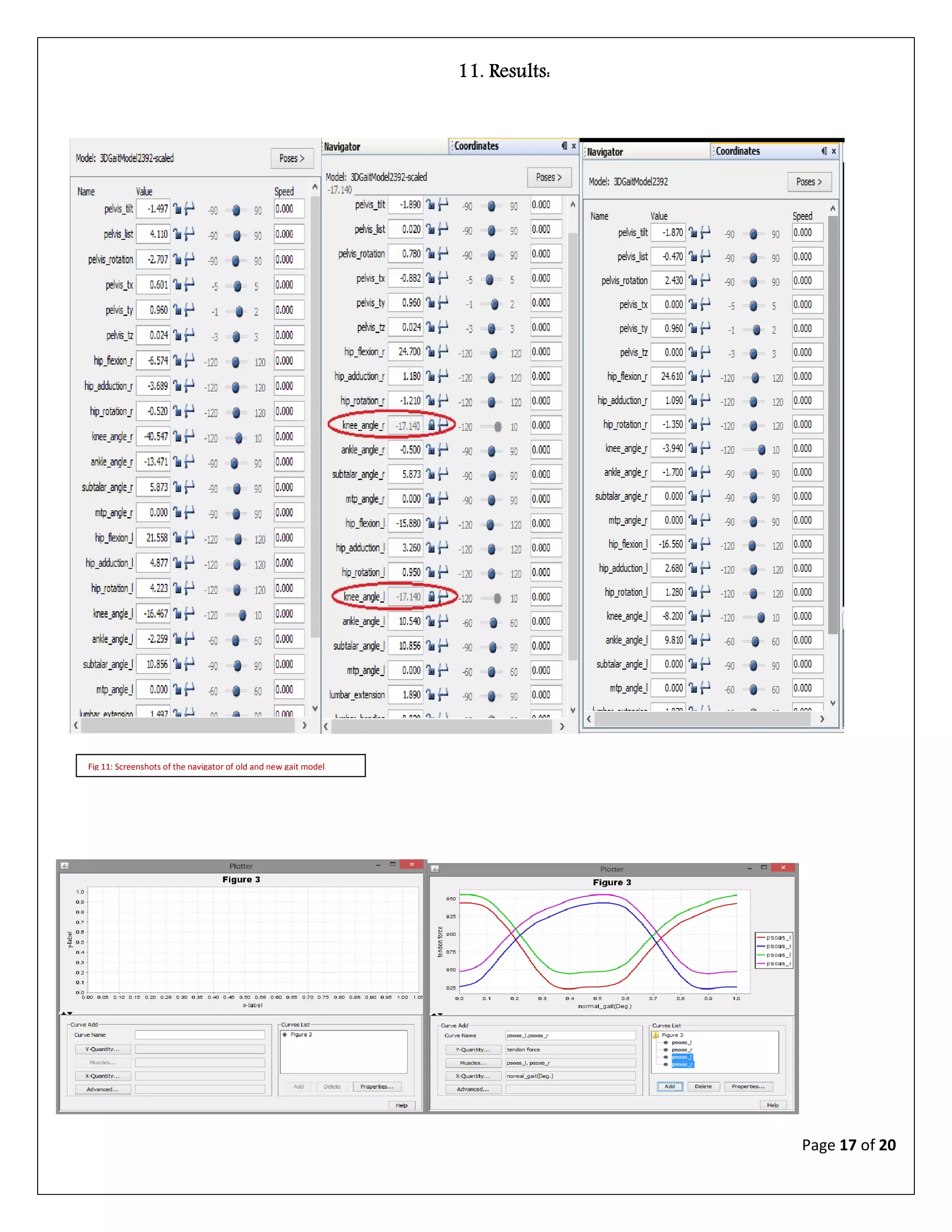 Pregnant lady gait analysis | PDF
