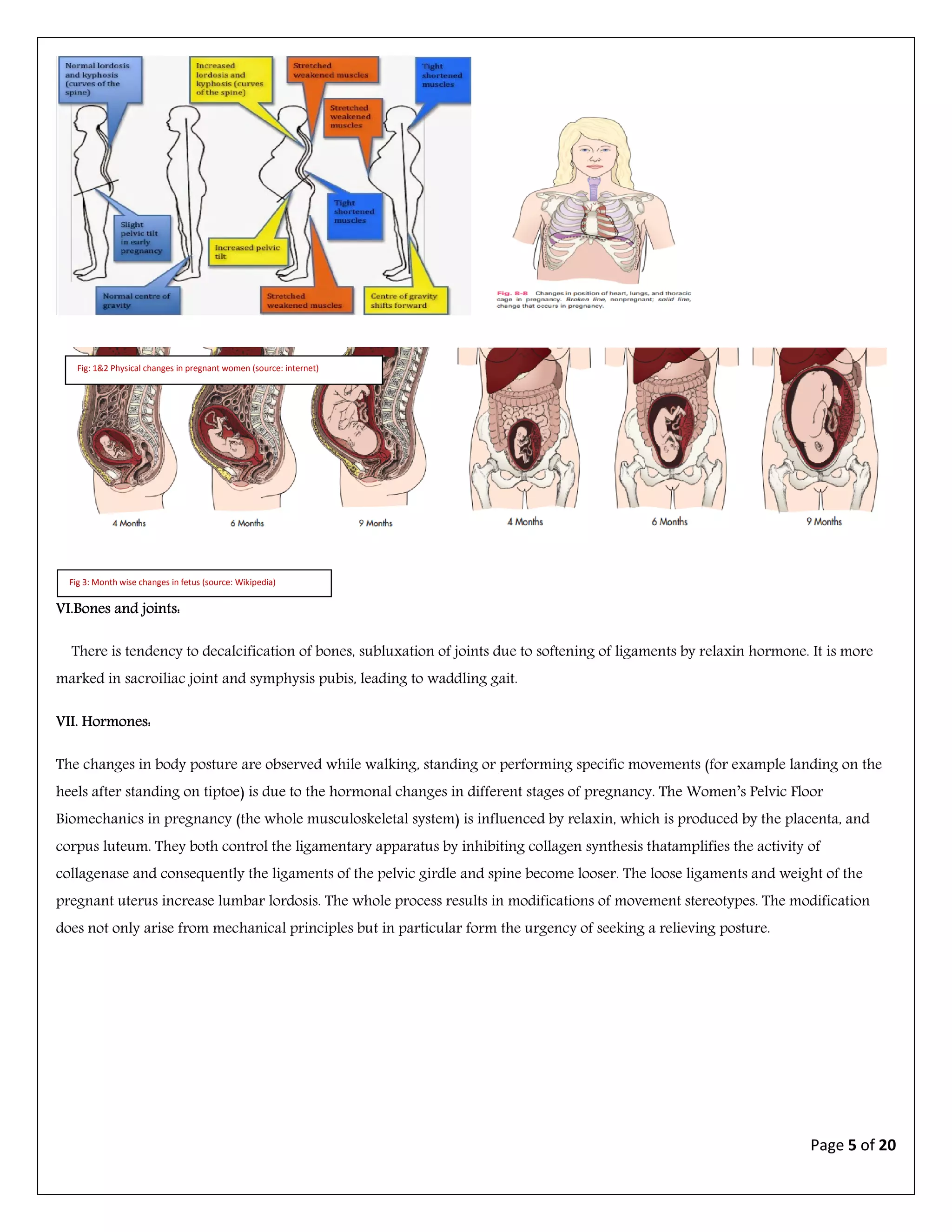 Pregnant lady gait analysis | PDF