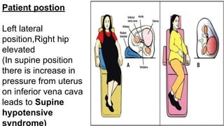 Pregnancy and dental treatment | PDF