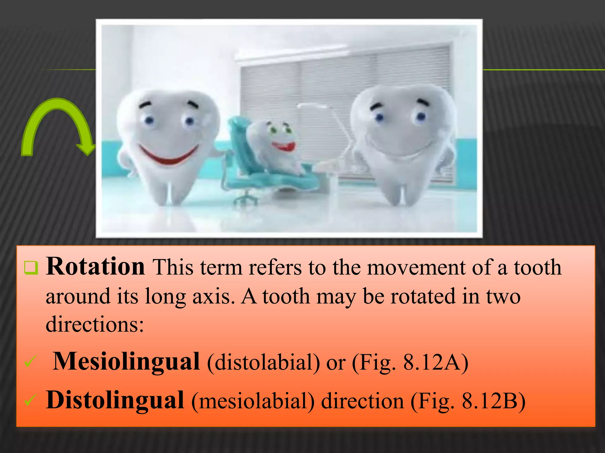 Classification of malooclusion | PPTX
