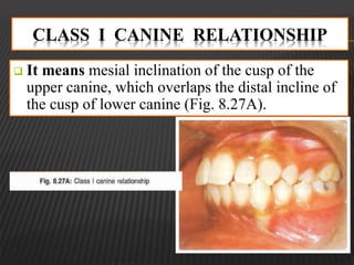 Classification of malooclusion | PPTX
