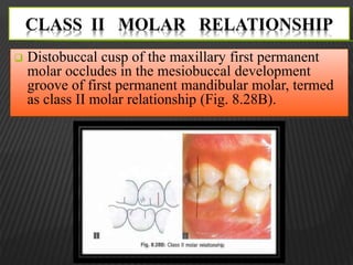 Classification of malooclusion | PPTX
