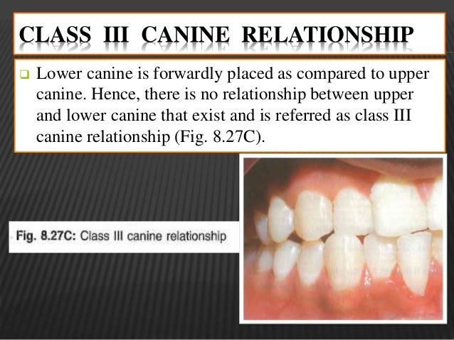 Classification of malooclusion