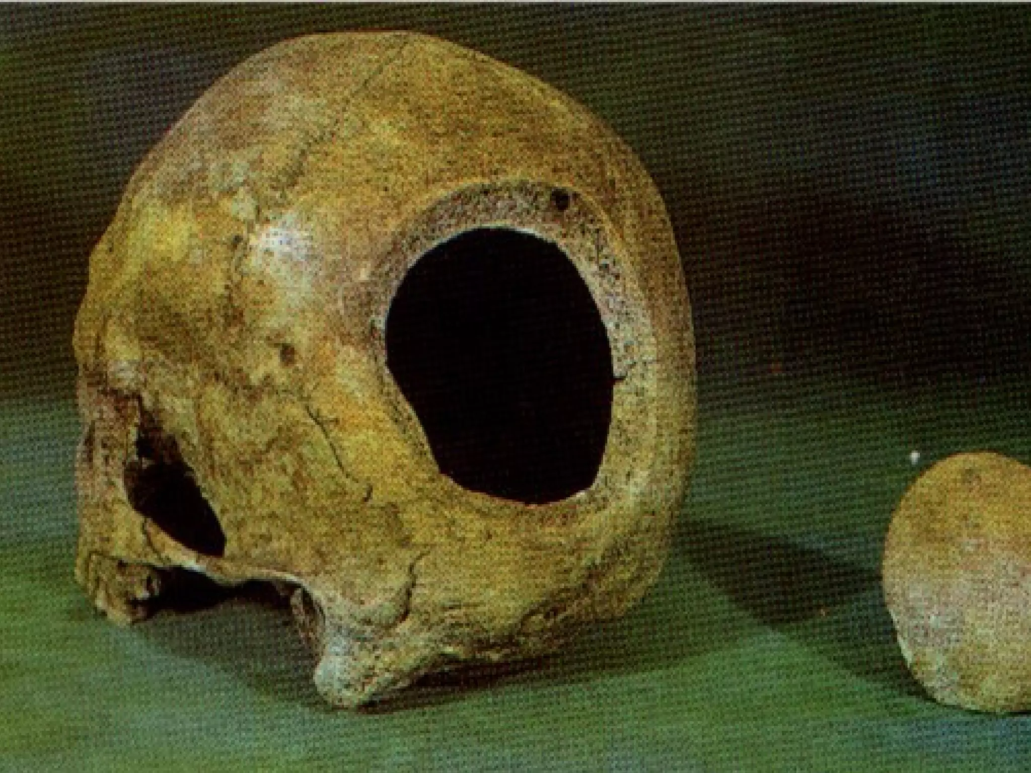 Prehistoric Medicine Lesson 2 | PPT