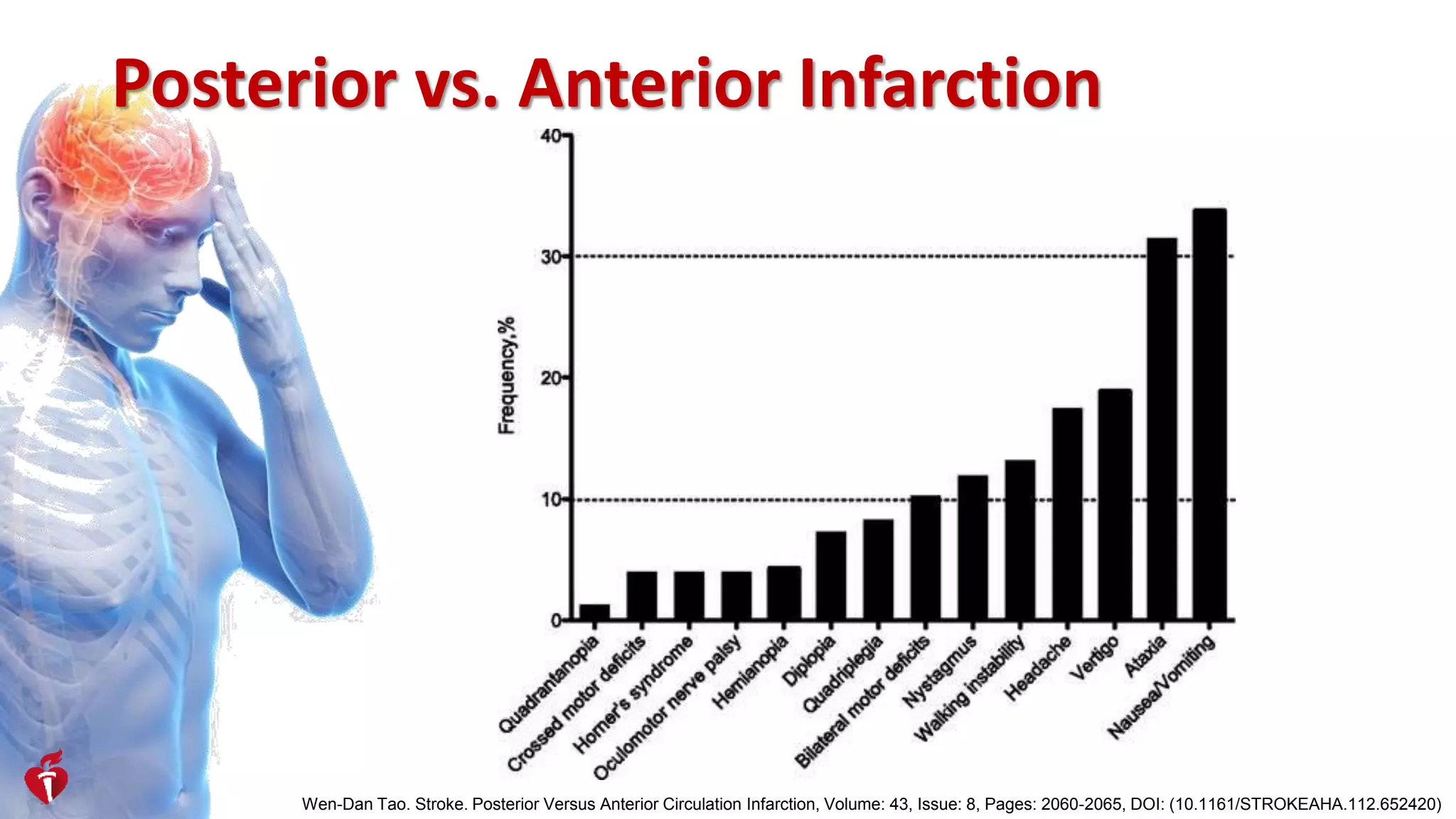 Prehospital Stroke Care | PPTX