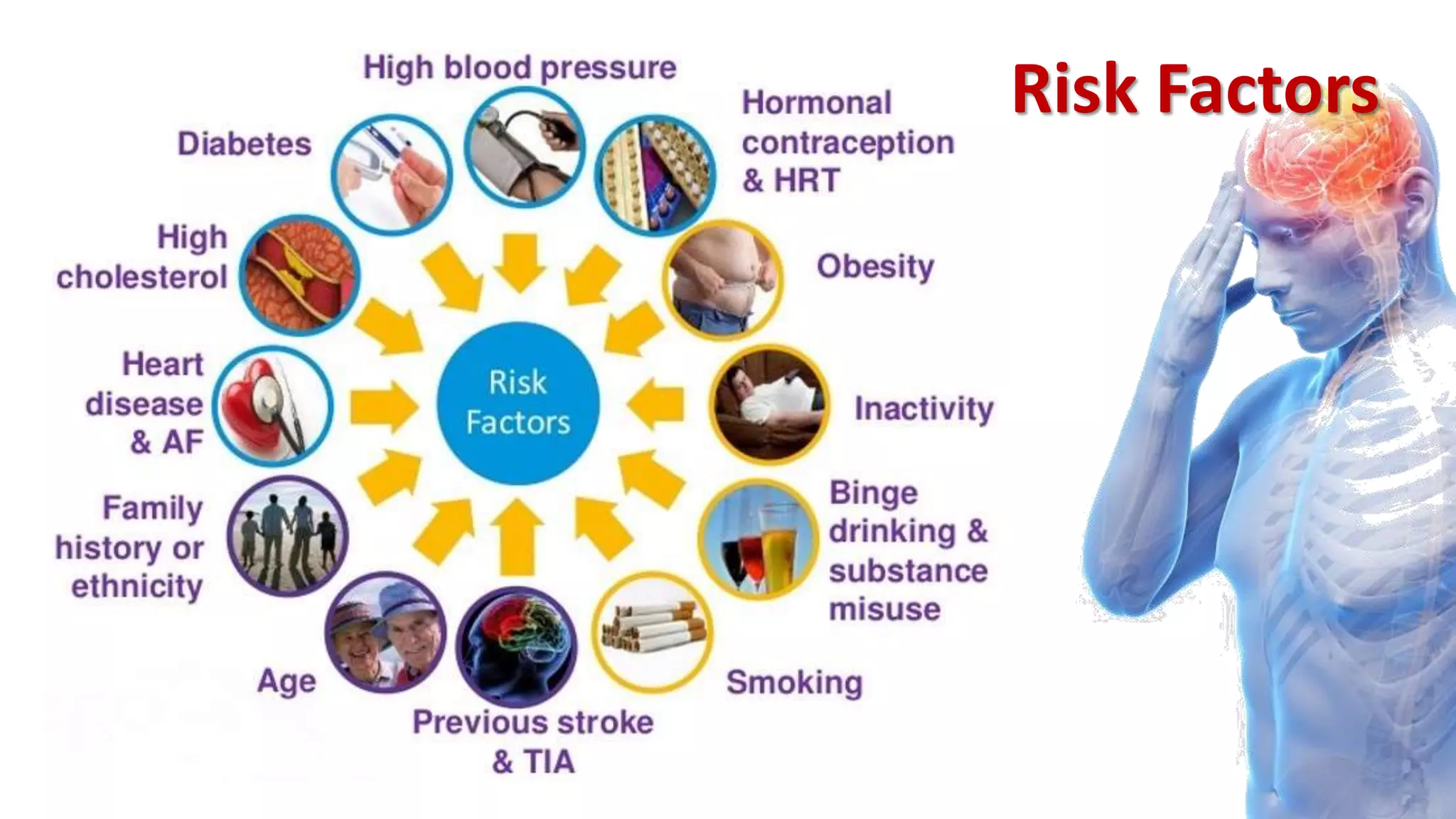 Prehospital Stroke Care | PPTX