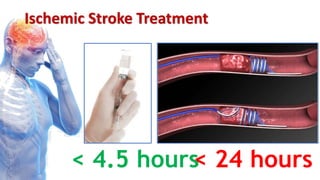 Prehospital Stroke Care | PPTX