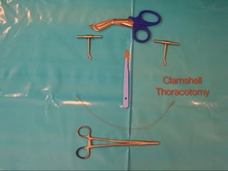 Prehospital thoracotomy debate | PPT | Free Download