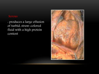 Preicardial disease | PPTX