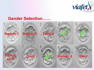 Preimplantation Genetic Testing-Viafet | PPTX