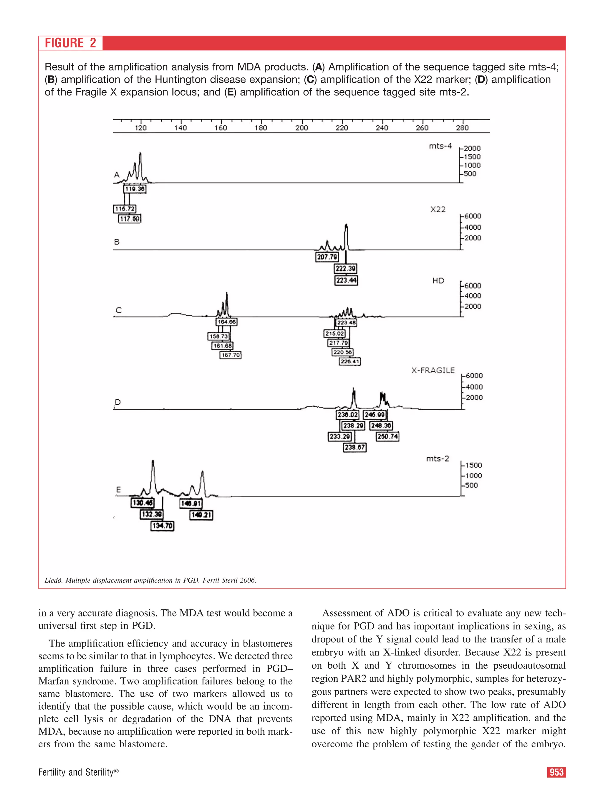 Preimplantation genetic diagnosis_of_marfan_syndrome_using_multiple ...