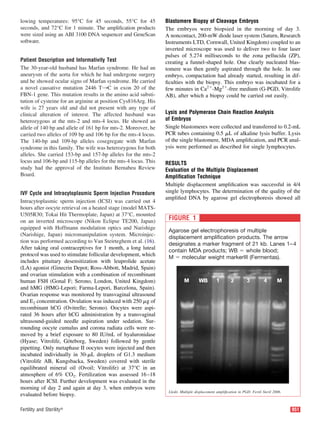Preimplantation genetic diagnosis_of_marfan_syndrome_using_multiple ...