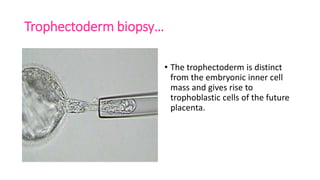 Preimplantation genetic diagnosis (pgd) PGD | PPTX