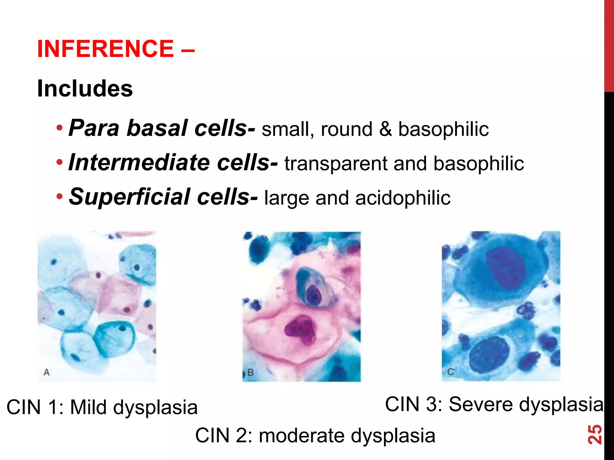 Preinvasive lesion of ca cervix(CIN) | PPTX
