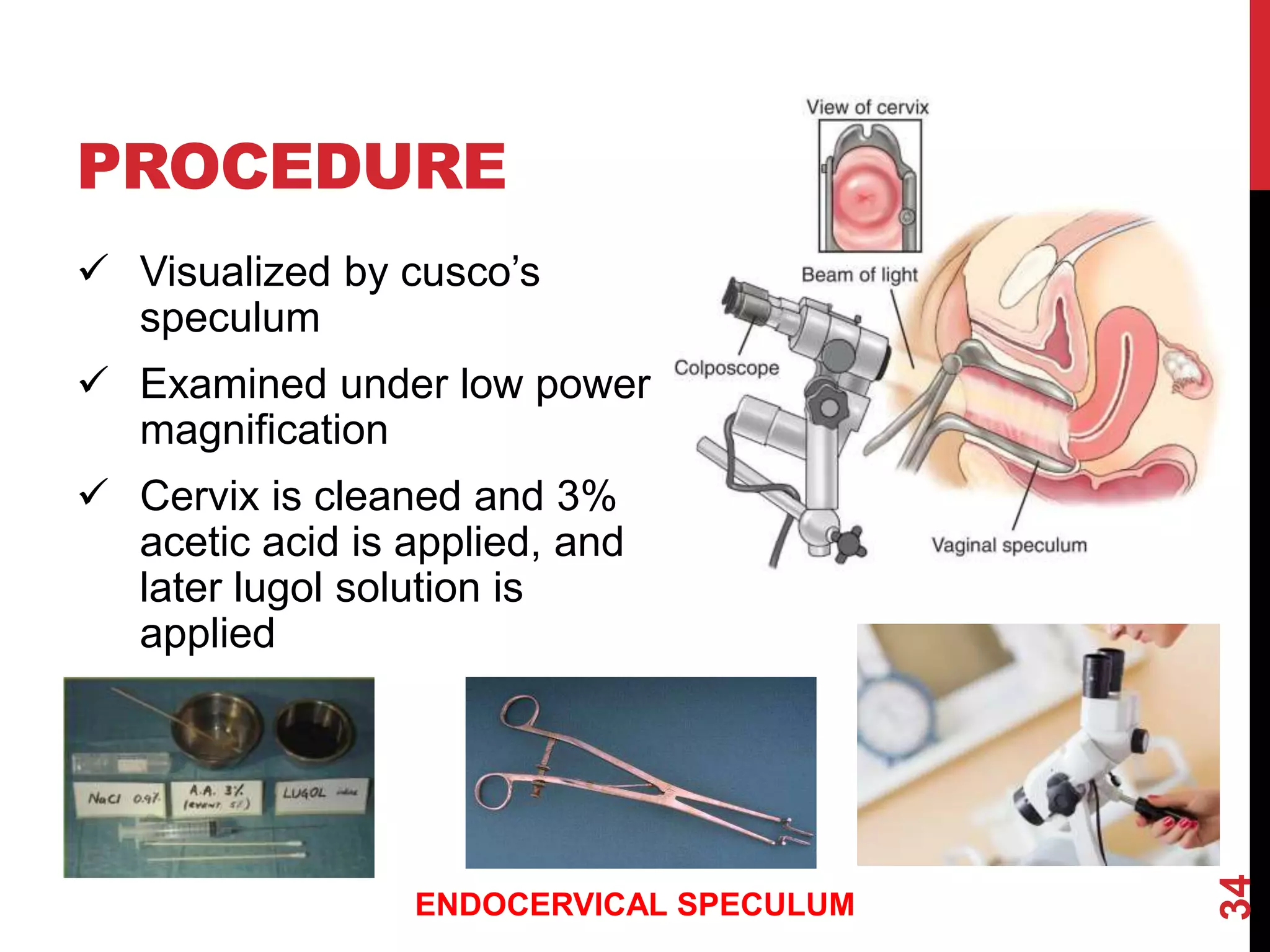 Preinvasive lesion of ca cervix(CIN) | PPTX