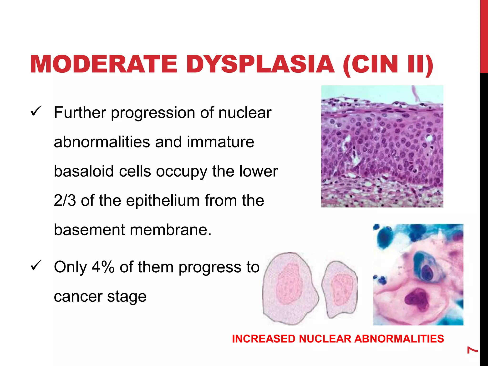 Preinvasive lesion of ca cervix(CIN) | PPTX