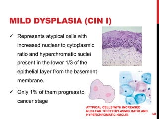 Preinvasive lesion of ca cervix(CIN) | PPTX