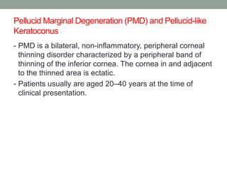 Prelasik evaluation | PPTX