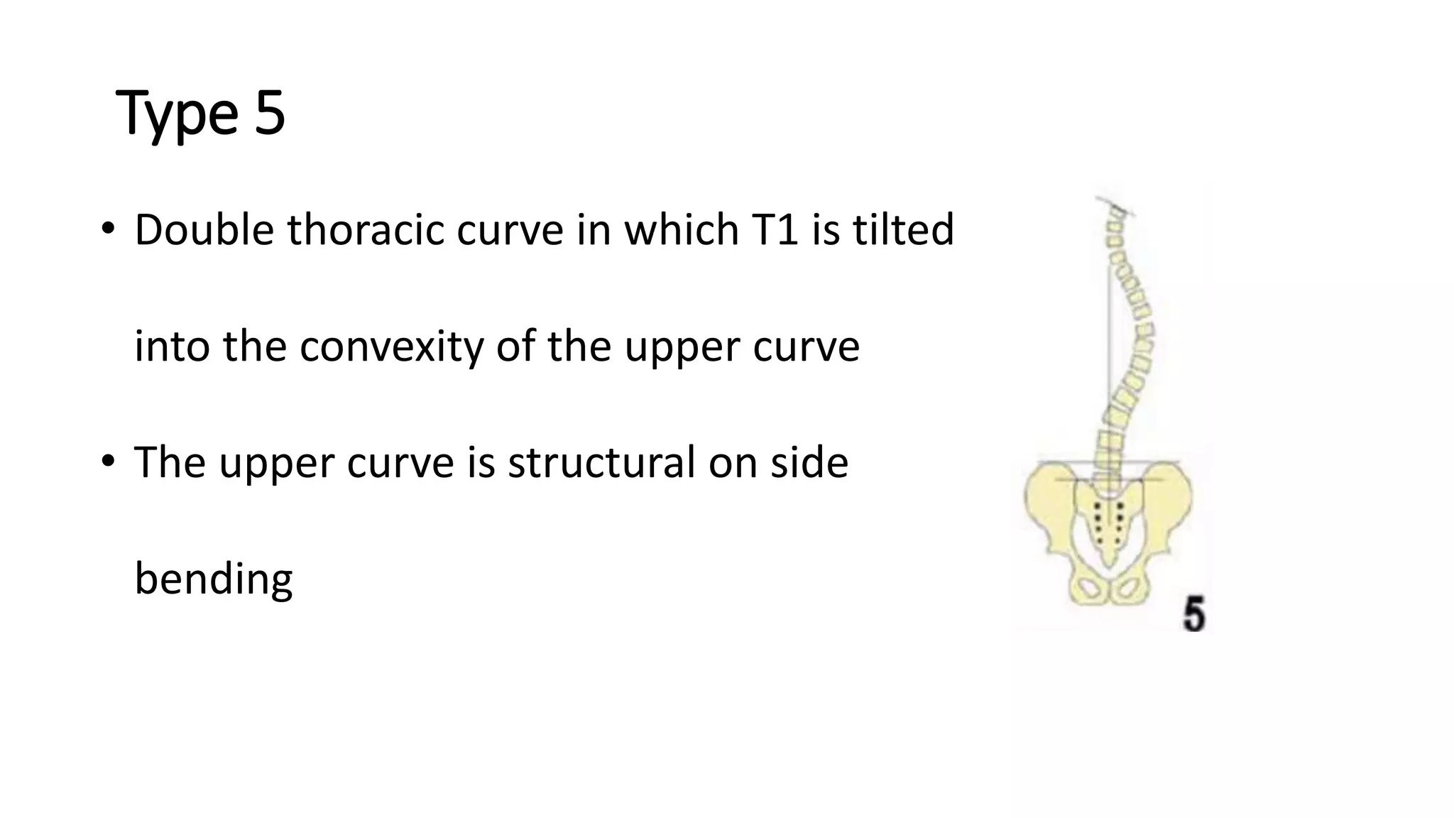 Pre lenke scoliosis classification.pptx