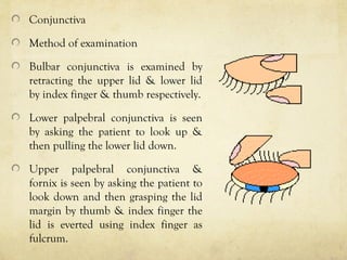 Preliminary examination | PPT