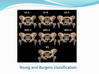 Preliminary management of pelvic injury | PPT