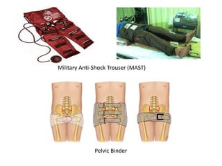 Preliminary management of pelvic injury | PPTX