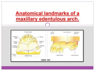 Preliminary prosthodontics | PPTX