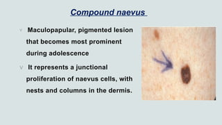 PREMALIGNANT Lesions of SKIN - (4).pptx