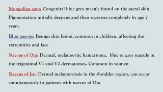 PREMALIGNANT Lesions of SKIN - (4).pptx