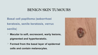 PREMALIGNANT Lesions of SKIN - (4).pptx